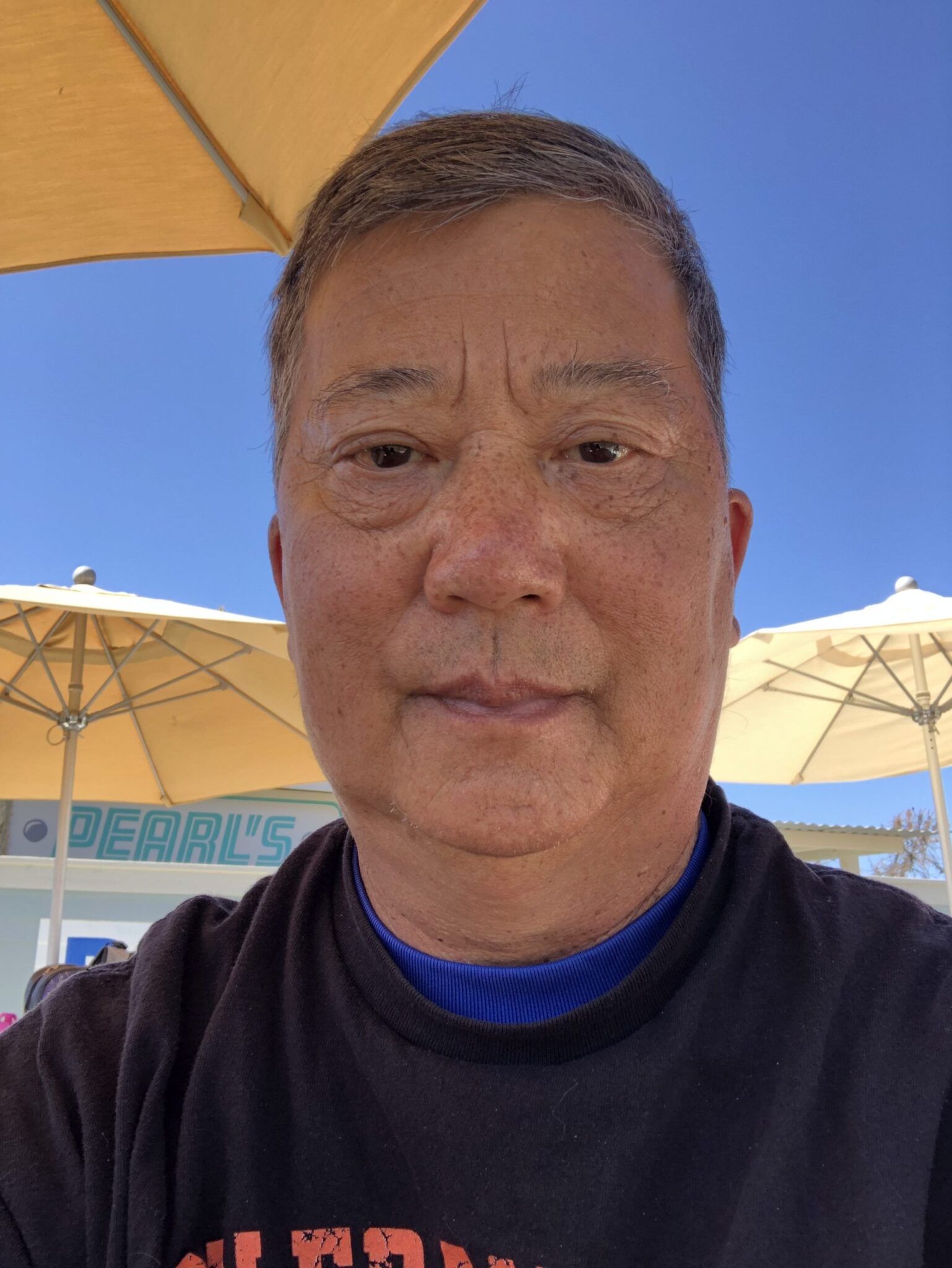 Who We Are - Bay Area Association of Kidney Patients